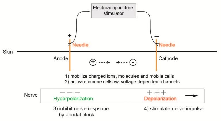 Electroacupuncture – Precision Acupuncture Clinic
